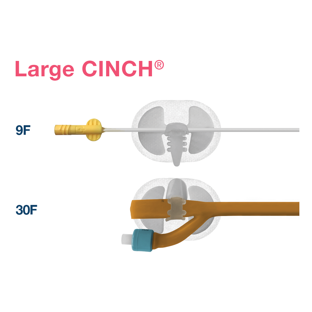 Buy AMT CINCH® | Bluestone Corporation