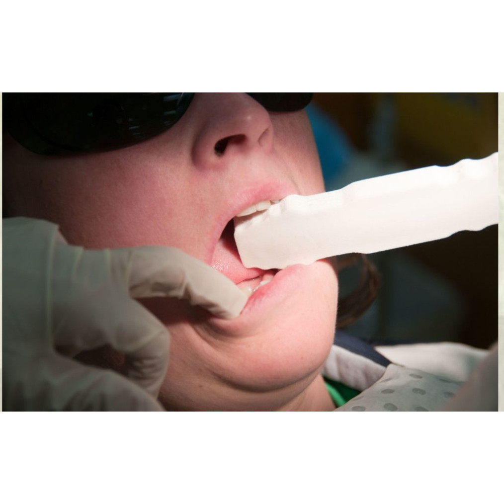 Buy Open Wide® Disposable Mouth Prop | Bluestone Corporation